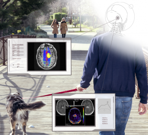 Neurology – Olea Medical