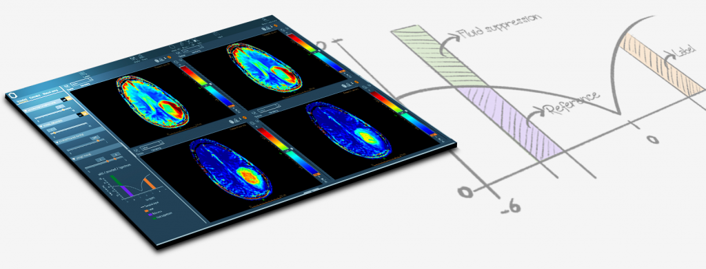 APT CEST – Olea Medical