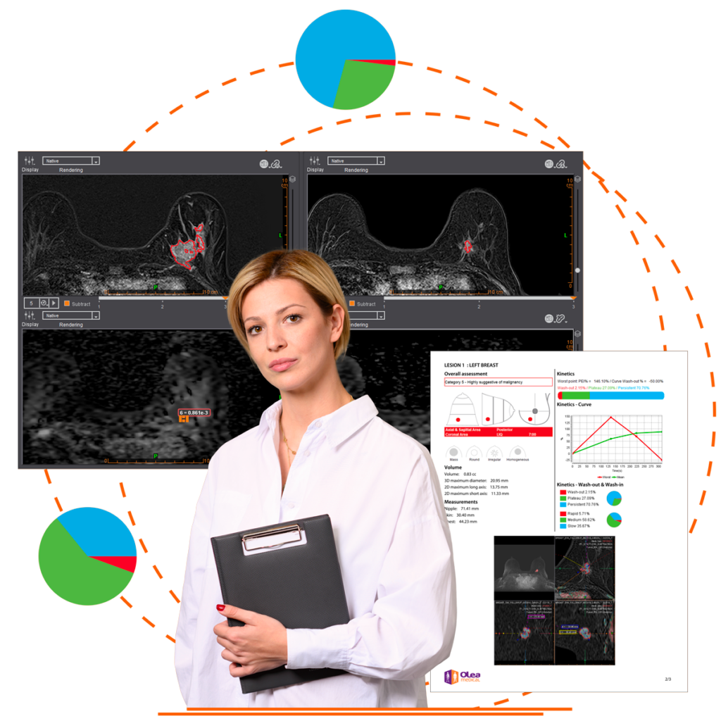 Female pelvic MRI and mammogram diagnostic imaging – Olea Medical
