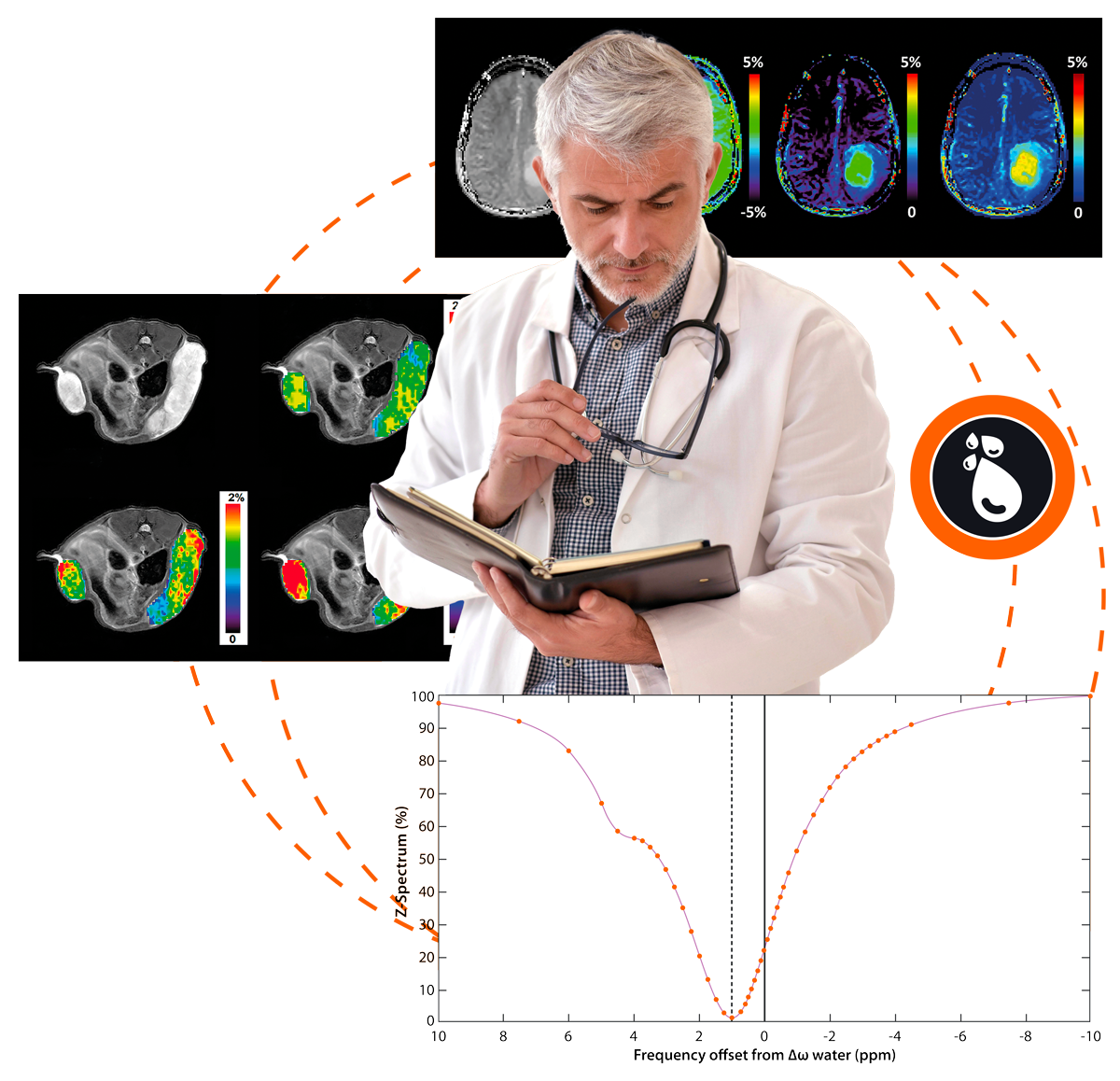 Neuroimaging: APT CEST imaging solution – Olea Medical