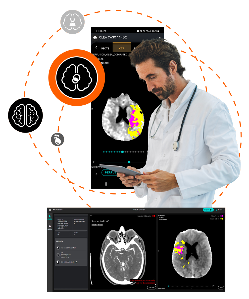 Emergency imaging analysis software – Olea Medical